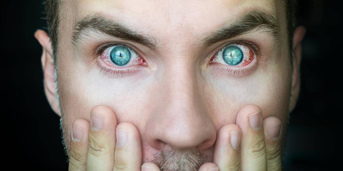 What is Fuchs' Dystrophy? All About This Progressive Cornea Disease ...