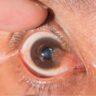 Understanding Pinguecula: Causes, Symptoms, and Treatment - Assil Gaur ...